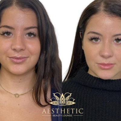 Cheeks On Fleek Highland Park & Chicago | Aesthetic Beauty Lounge